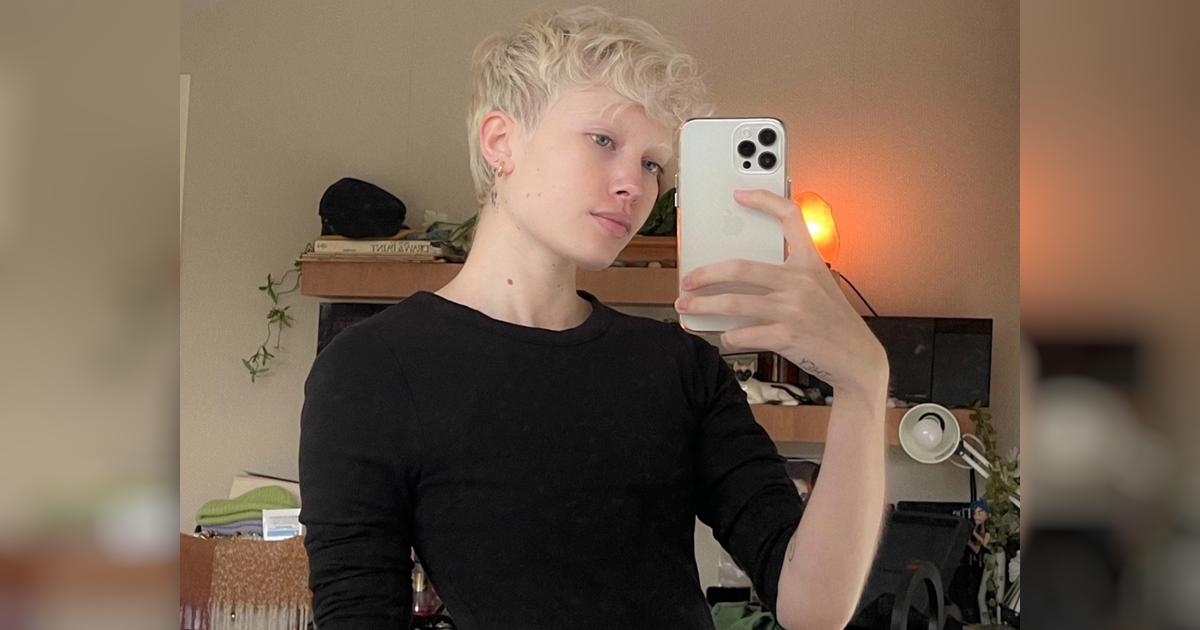 Help a Non-binary/Trans Person Get Top Surgery - Givealittle