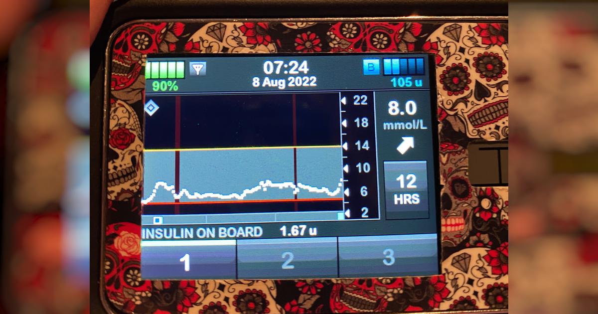 CGM Funds for Em - Givealittle