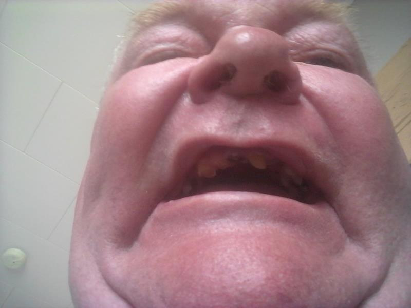 broken smashed teeth - Givealittle