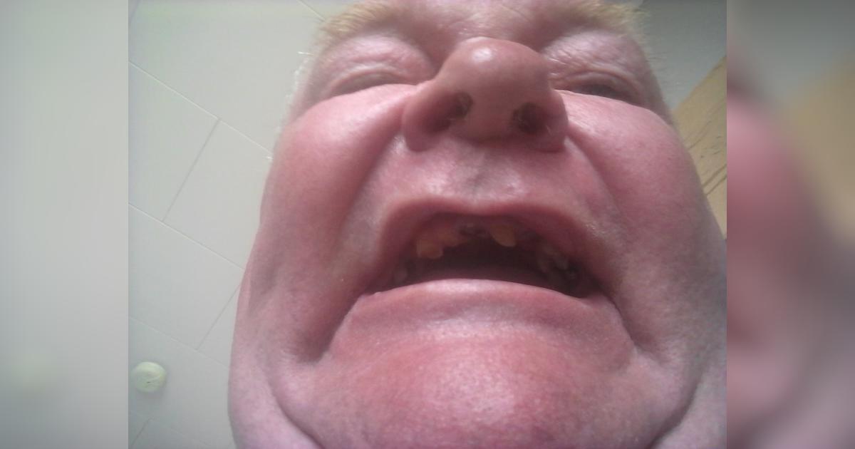 broken smashed teeth - Givealittle