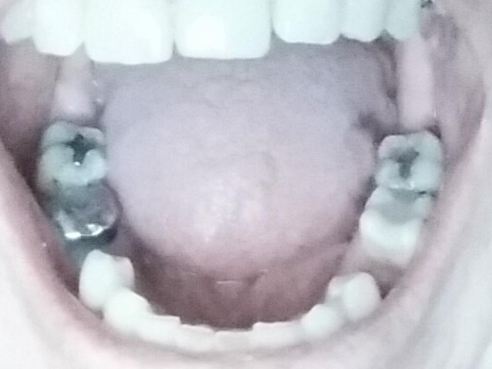 Help me fix my teeth and live without pain - Givealittle