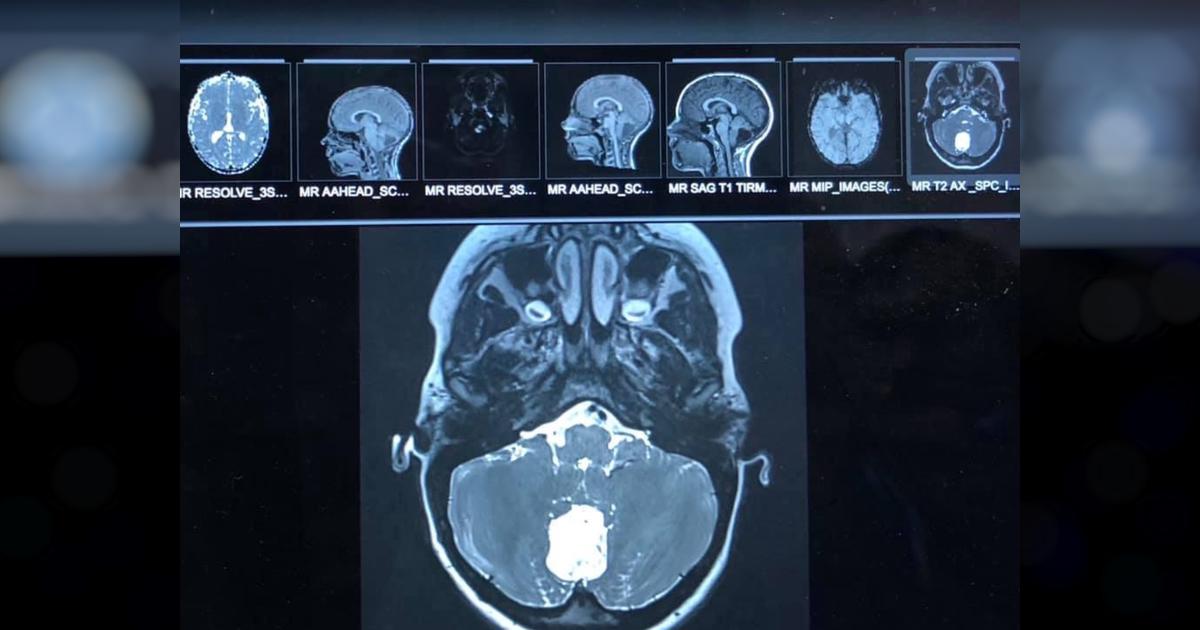 Harriet’s Recovery from Brain Surgery - Givealittle