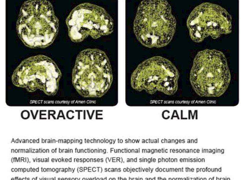 Helping Families with the Costs of Irlen Spectral Filters Tests and ...