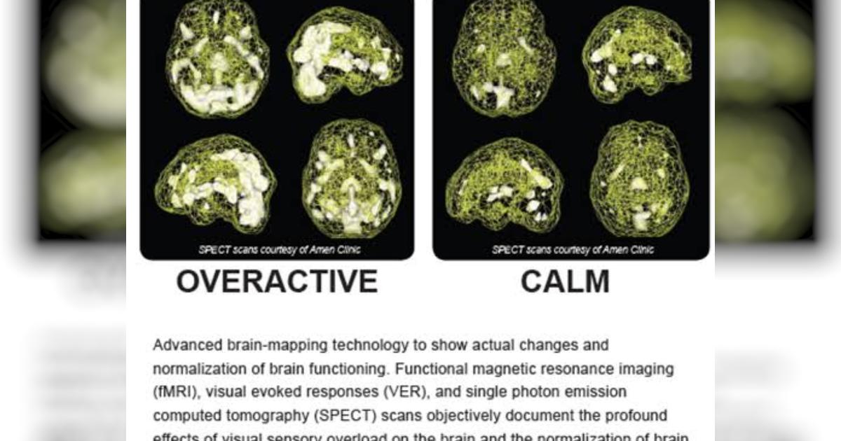 Helping Families with the Costs of Irlen Spectral Filters Tests and ...
