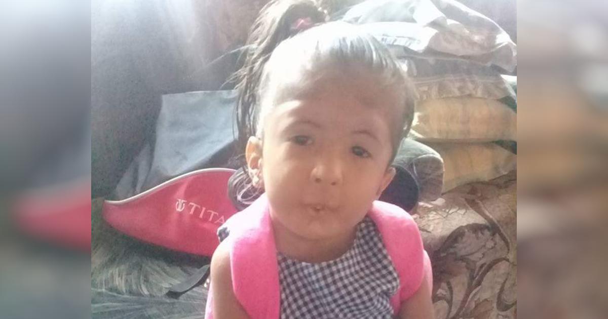 Ease Tanvi's journey (Freeman-Sheldon syndrome). - Givealittle