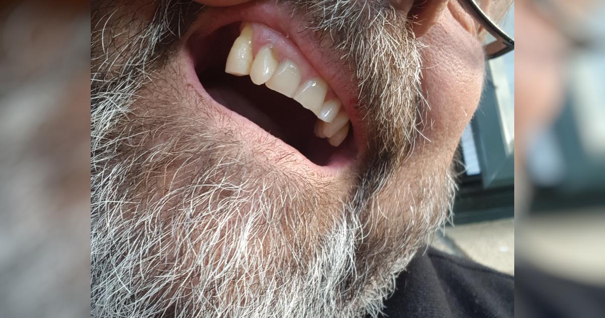 My Teeth are falling out. - Givealittle