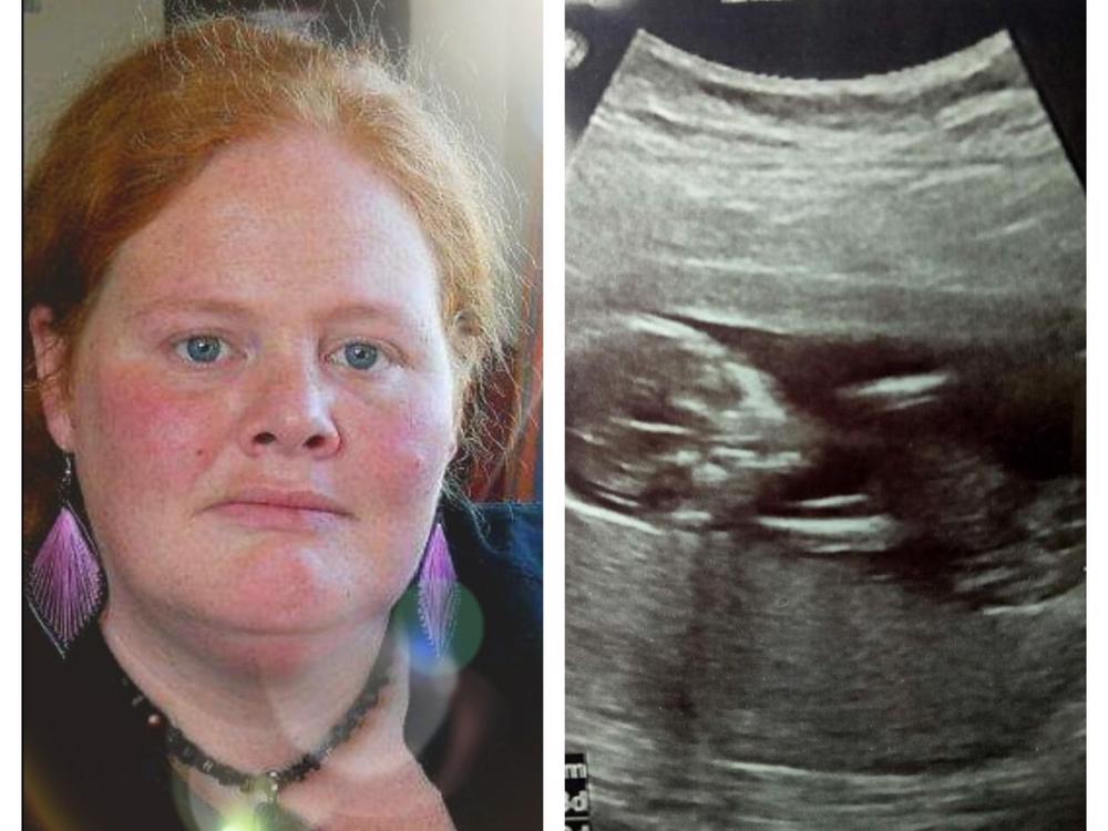 Amy Thorpe and baby thorpe - Givealittle