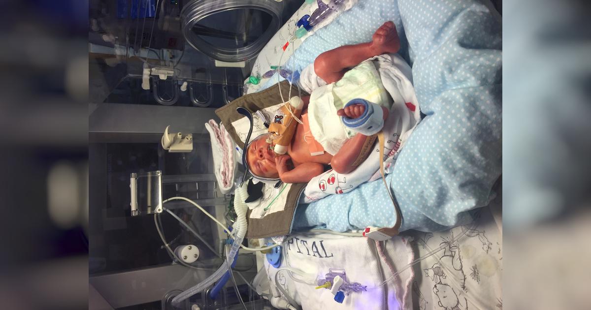 Love for baby rautahi - Givealittle