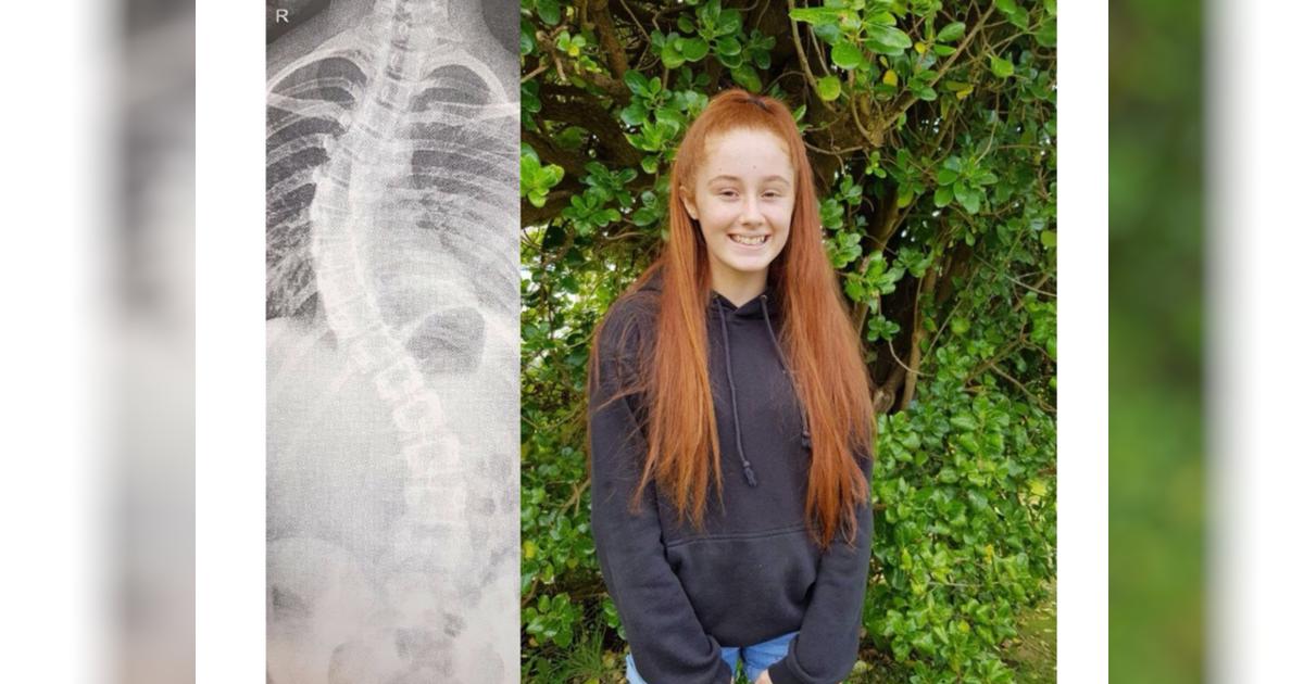 Darnae's Scoliosis Journey - Time is of the essence! - Givealittle
