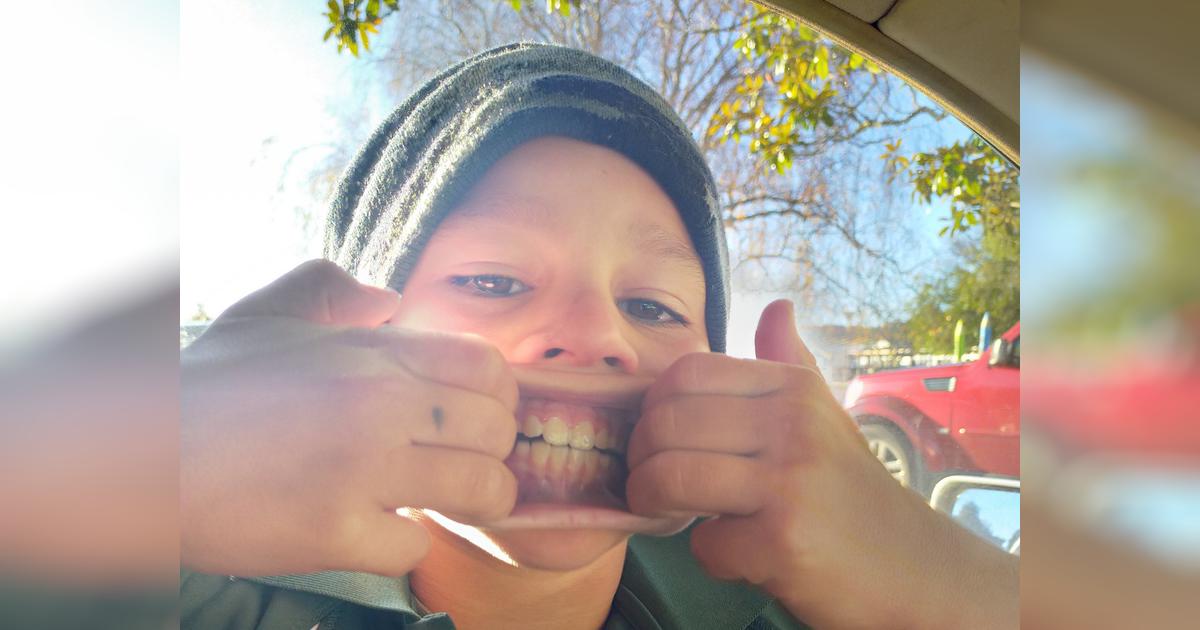 Koby's chance to learn his way! - Givealittle