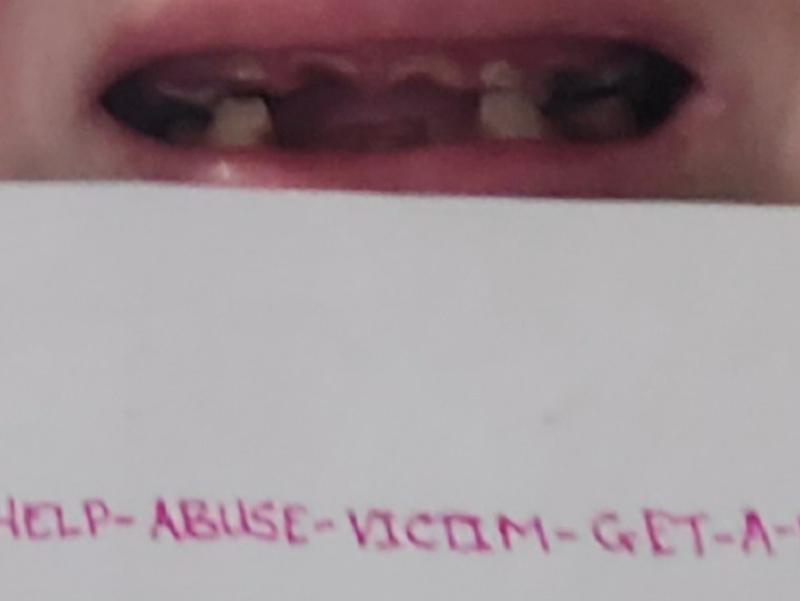 Help abuse victim get a new smile - Updates - Givealittle