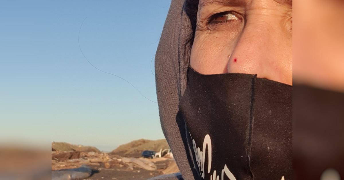 Please help.me smile again - Givealittle