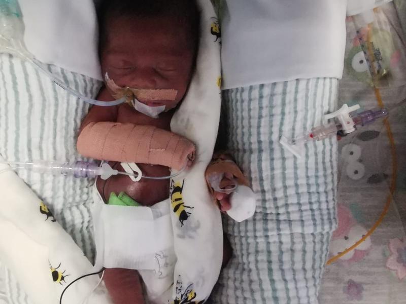 Give a little for a strong warrior micro- preemie and mom with ovarian ...