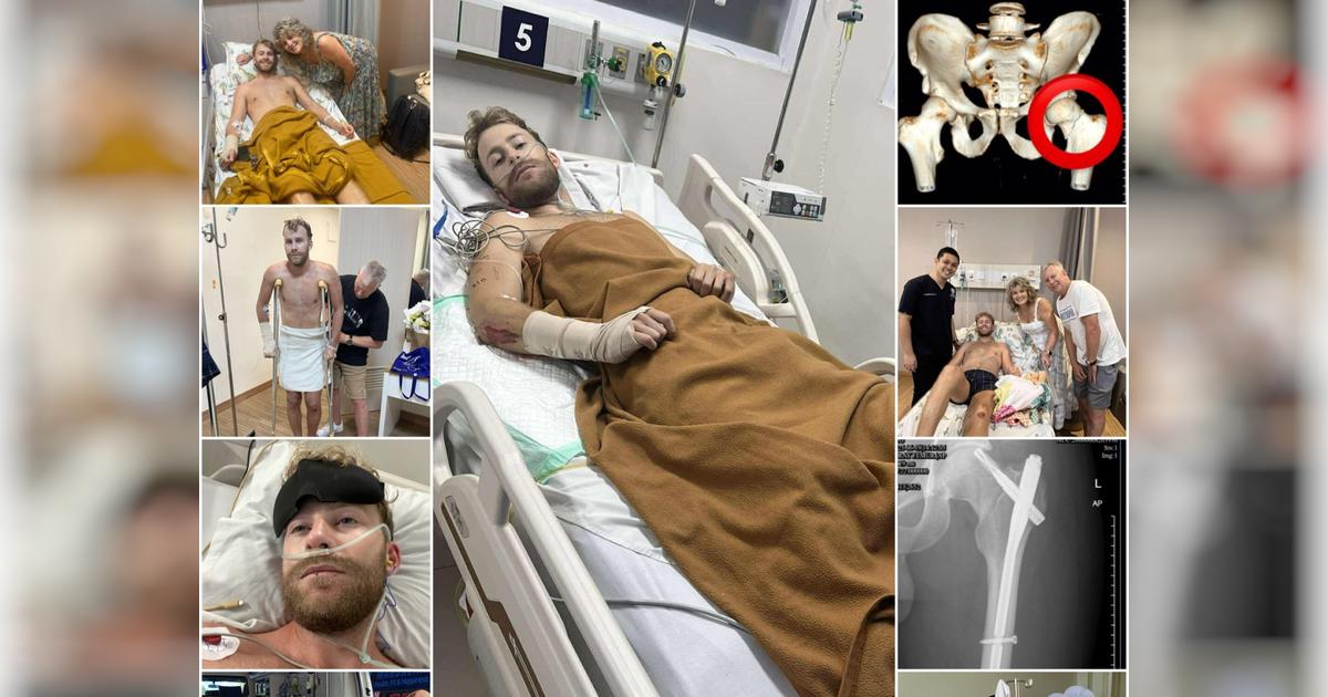 Let's continue to support Joel's recovery 例 喙 - Givealittle