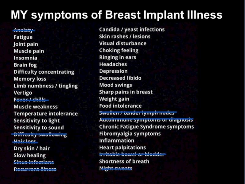 Breast Implant Illness I Need Your Help To Remove These Toxic Bags