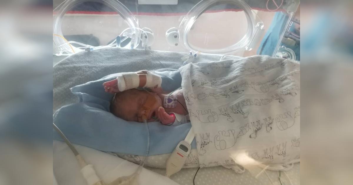 Baby Abel fighting for his life - Givealittle