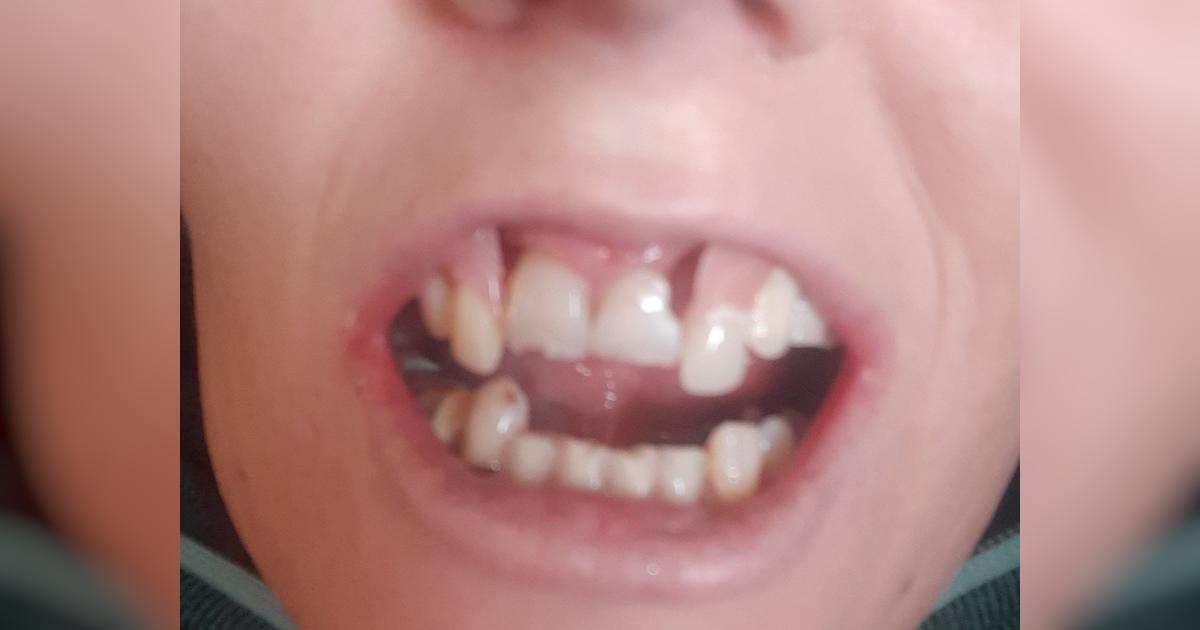 please help me smile again - Givealittle