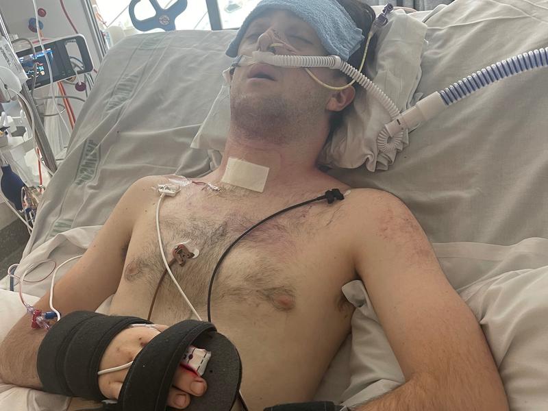 Help Taidgh Turn Tragedy to Triumph - Updates - Givealittle