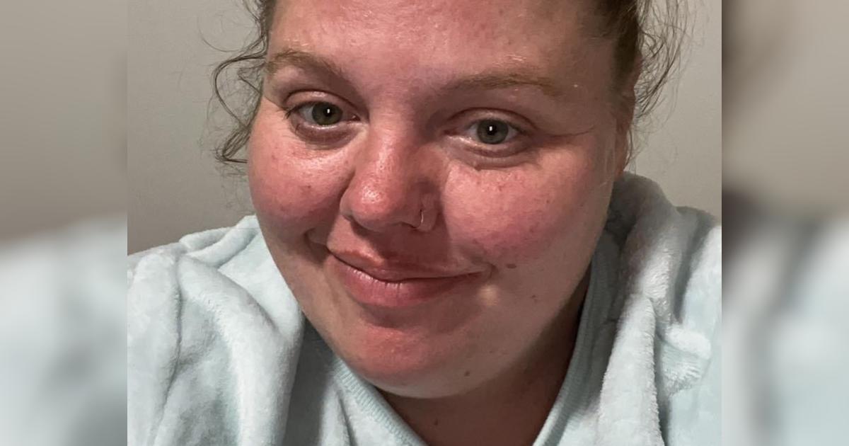 Help Chloe get another electric scooter - Givealittle