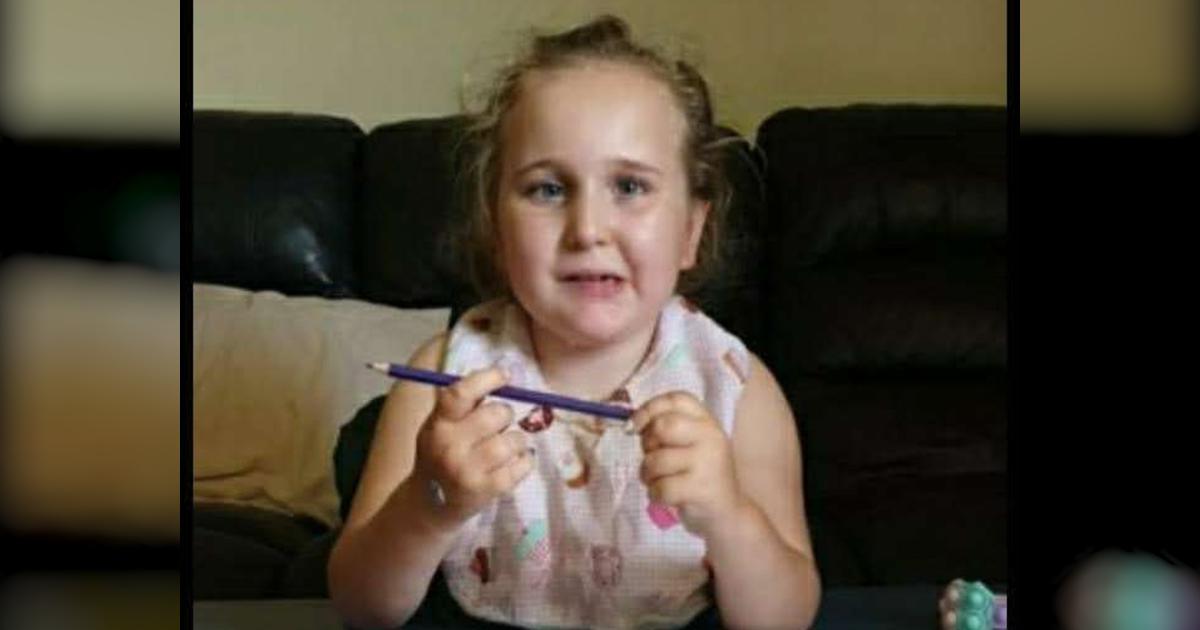 Please help fund non-government funded medicine reducing size of brain ...